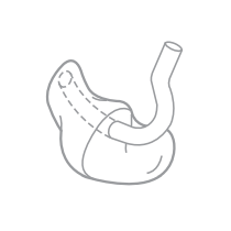 イヤモールド｜スターキージャパンプロ